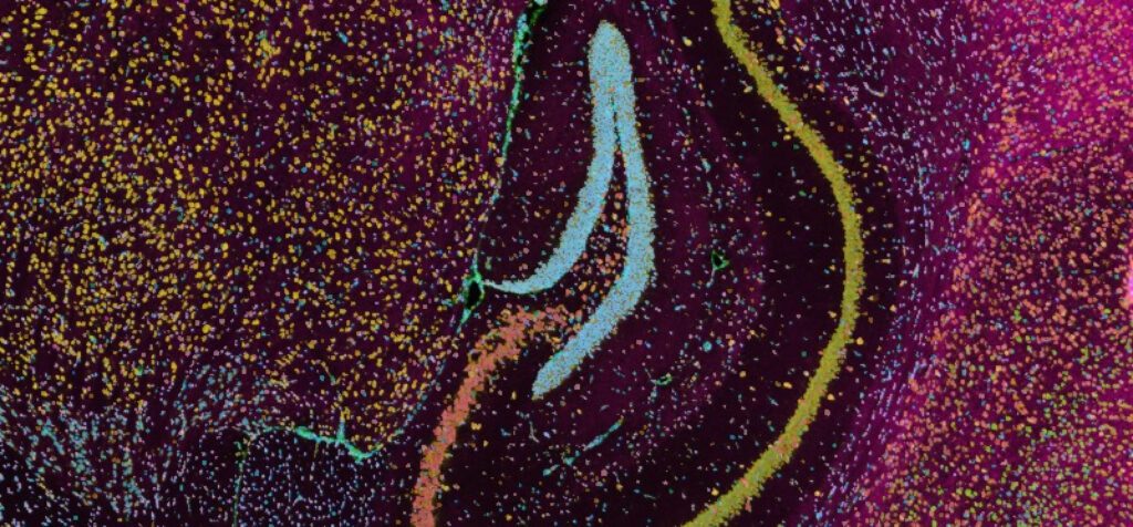 Single Cell Sequencing | Singulomics Corporation